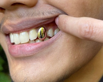 Custom Butterfly Tooth Cap Grill Gold VVS Rubys - Etsy UK