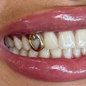 Classic Heart Window Tooth Cap! Custom Grillz, FREE Shipping! - Etsy