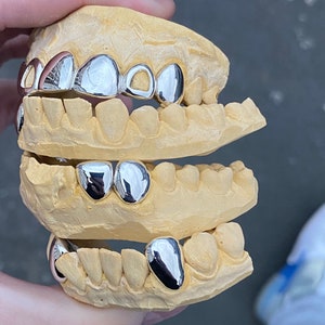 925 Sterling Silver Tooth Cap Grillz - Etsy UK