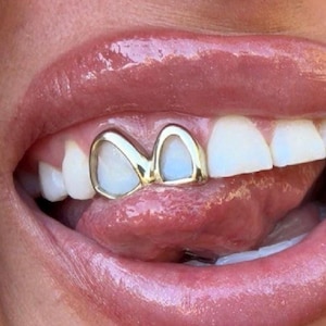 Double Window Tooth Grillz: Custom Gold/silver Caps - Etsy