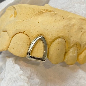 Gold Window/open Face Grillz Tooth Cap Worldwide Shipping White, Rose ...