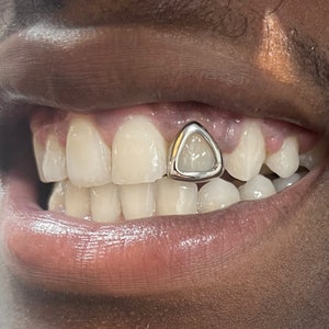 Gold Window/open Face Grillz Tooth Cap Worldwide Shipping White, Rose ...