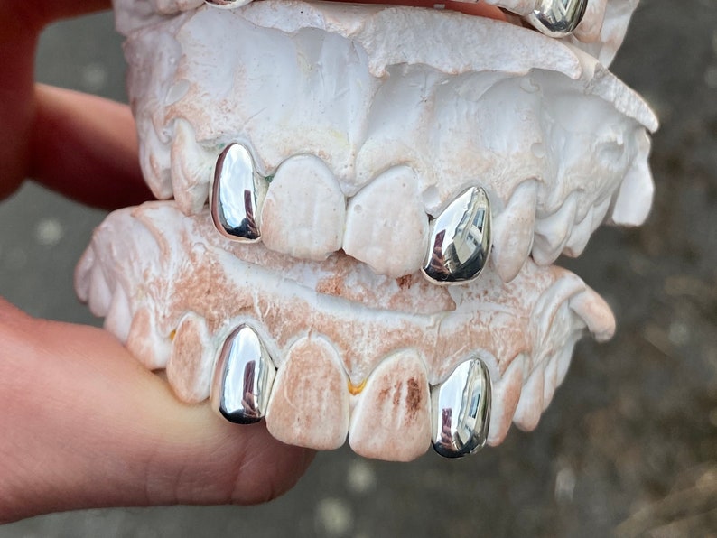 2x Sterling Silver 925 Grillz Any Teeth UK Worldwide Shipping - Etsy