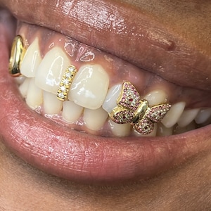 Custom Butterfly Tooth Cap Grill, Gold, VVS, Rubys - Etsy UK