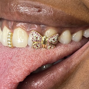 Custom Butterfly Tooth Cap Grill, Gold, VVS, Rubys - Etsy UK