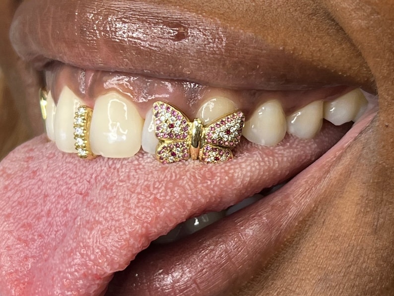Custom Butterfly Tooth Cap Grill Gold VVS Rubys - Etsy UK