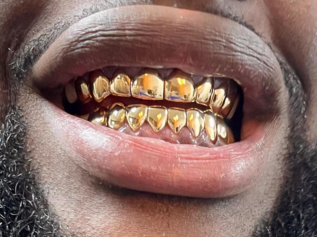 Solid Gold Perm Cut Grillz: Custom Fit 10K/18K - Etsy