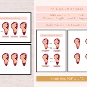 Cervical Effacement and Dilation | PNG Images & Canva | PDF + JPG ...