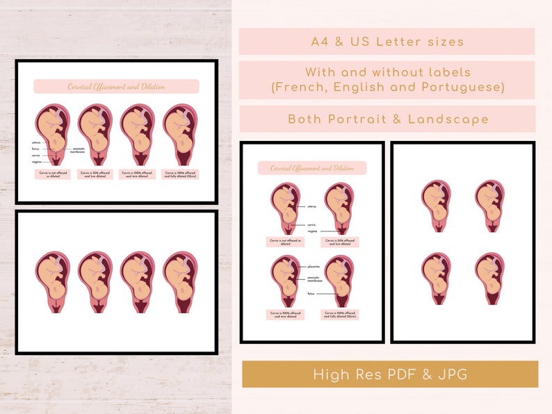 Cervical Effacement and Dilation | PNG Images & Canva | PDF + JPG ...