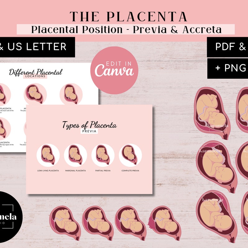 Placenta - Etsy