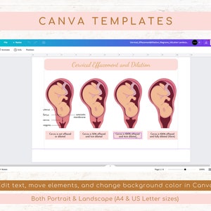 Cervical Effacement and Dilation | PNG Images & Canva | PDF + JPG ...
