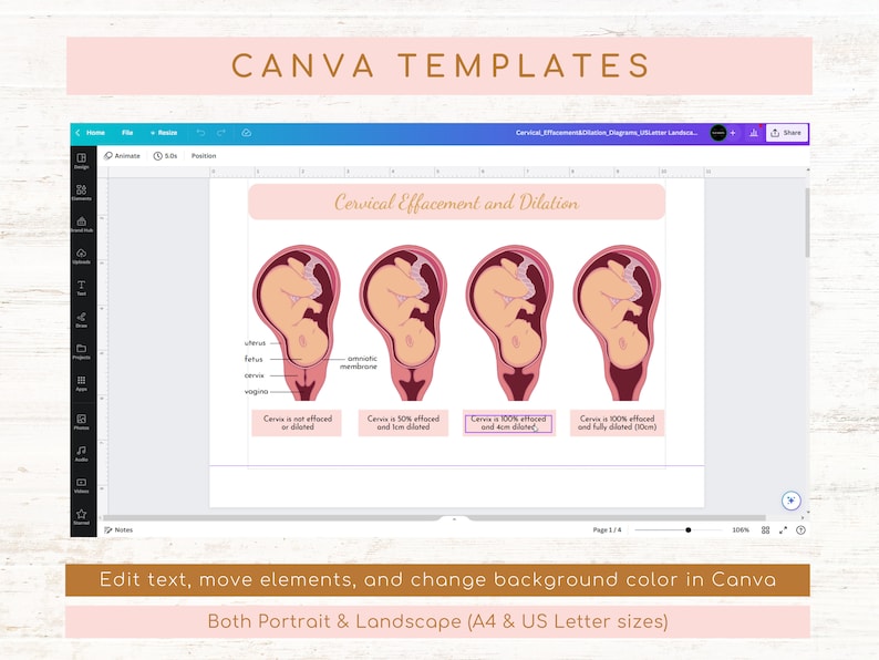 Cervical Effacement and Dilation | PNG Images & Canva | PDF + JPG ...
