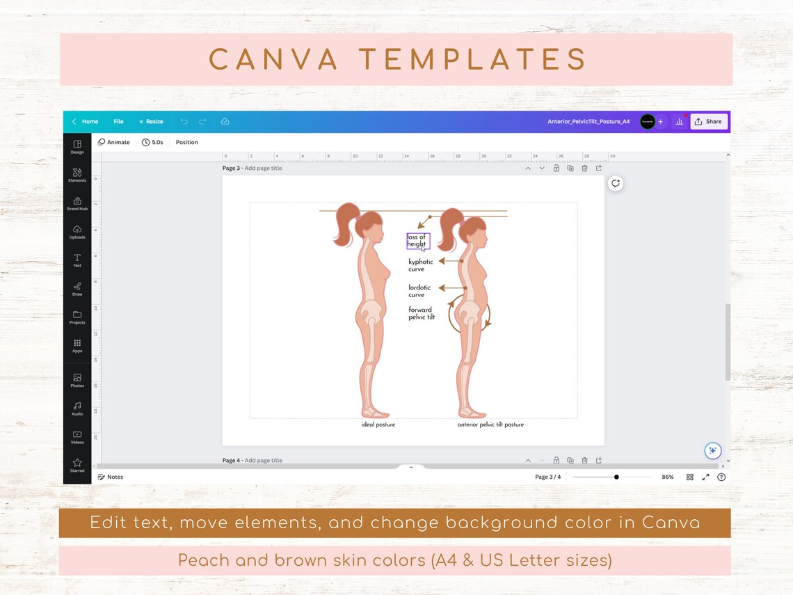 Anterior Pelvic Tilt and Neutral Posture | PDF + JPG | PNG & Canva ...