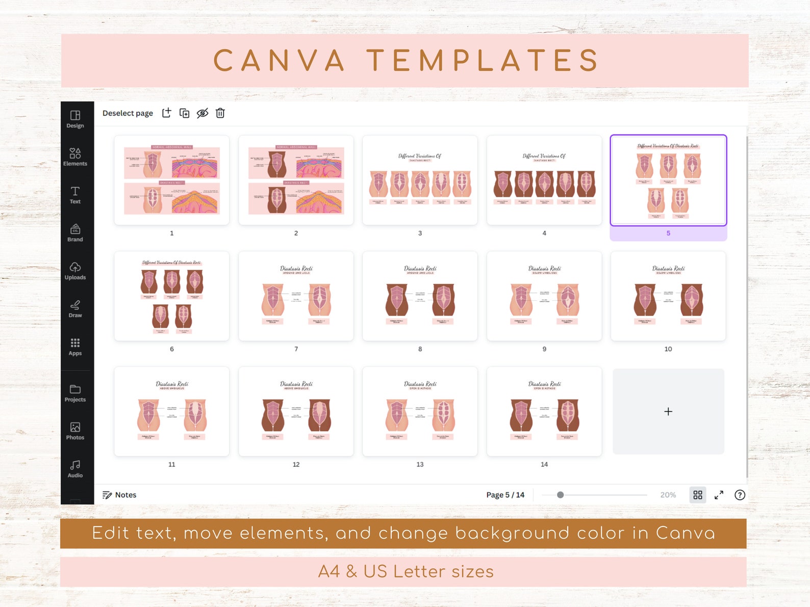 Diastasis Recti Variations Diagram | Abdominal Muscles Separation ...