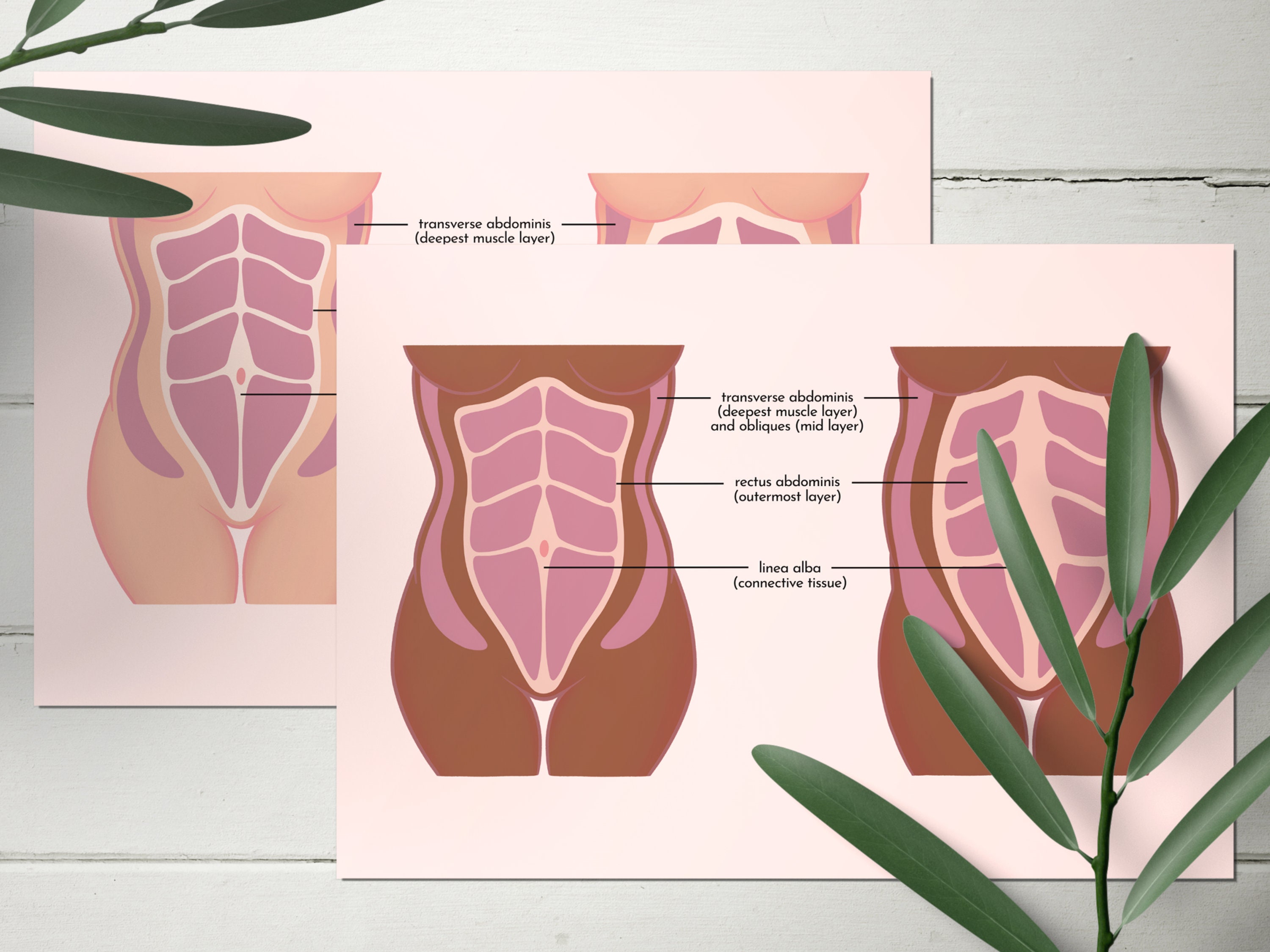 Diastasis Recti Diagram Abdominal Muscles Separation After - Etsy