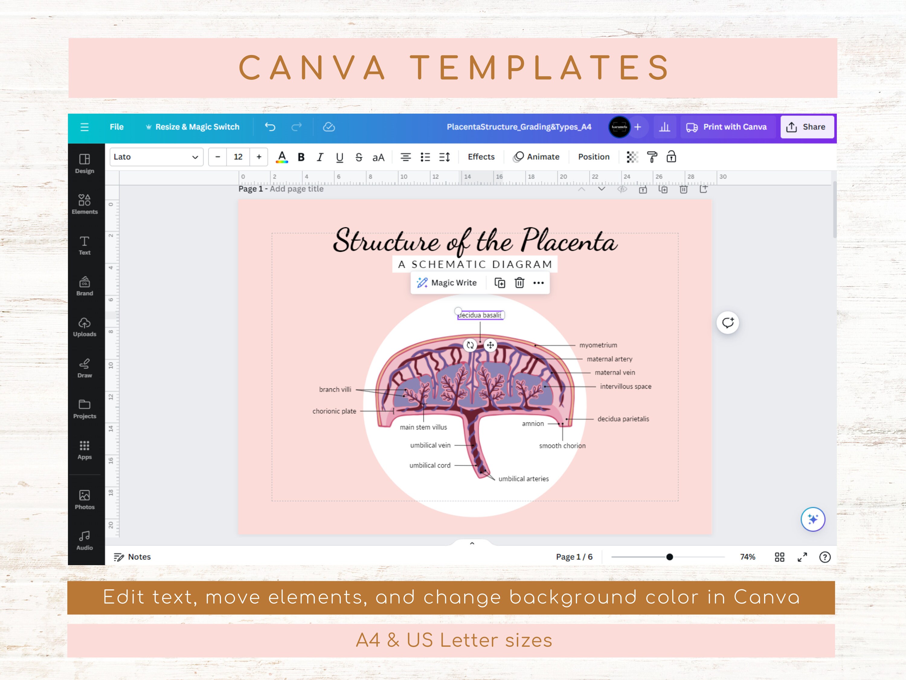 Placenta Structure | Placenta Grading | Different Placenta Types | PNG ...