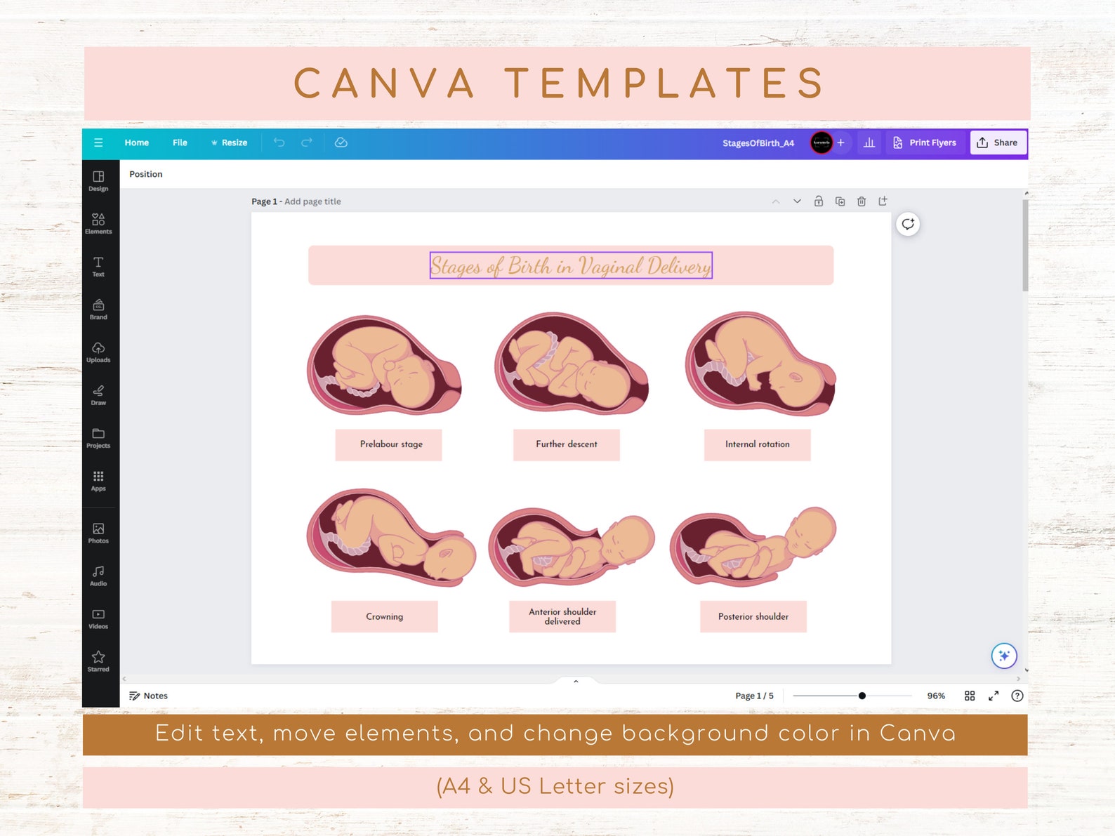 Mechanism of Labour | Stages of Birth | PNG Images & Canva | PDF + JPG ...