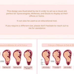 Cervical Effacement and Dilation | PNG Images & Canva | PDF + JPG ...