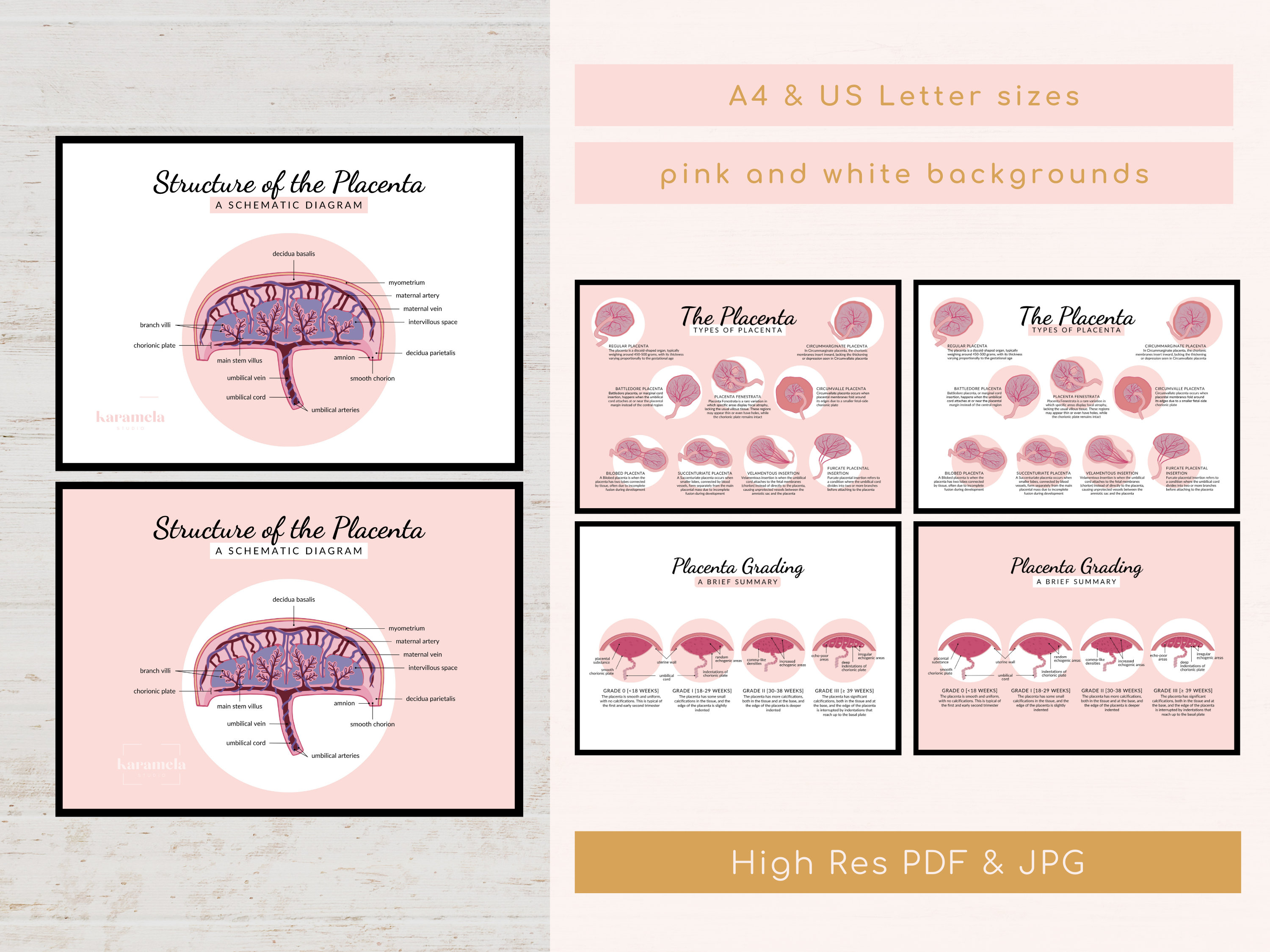 Placenta Structure | Placenta Grading | Different Placenta Types | PNG ...