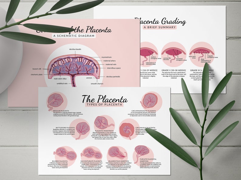 Placenta Structure | Placenta Grading | Different Placenta Types | PNG ...