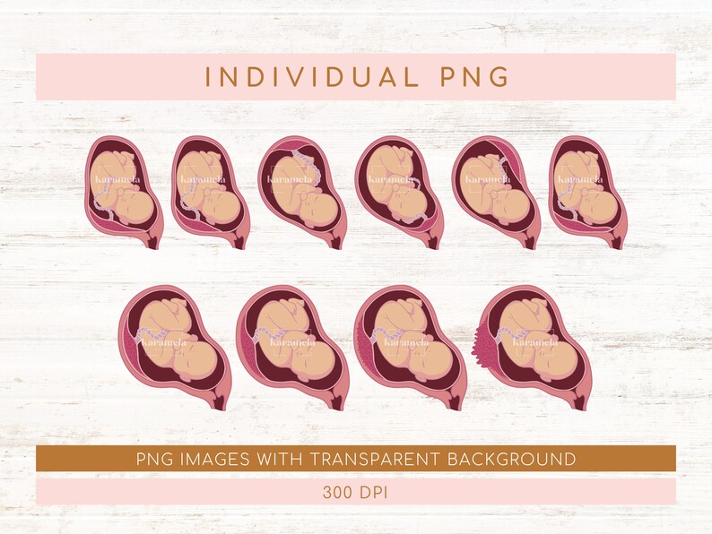 Different Placental Positions Types of Placenta Previa Placenta Accreta ...