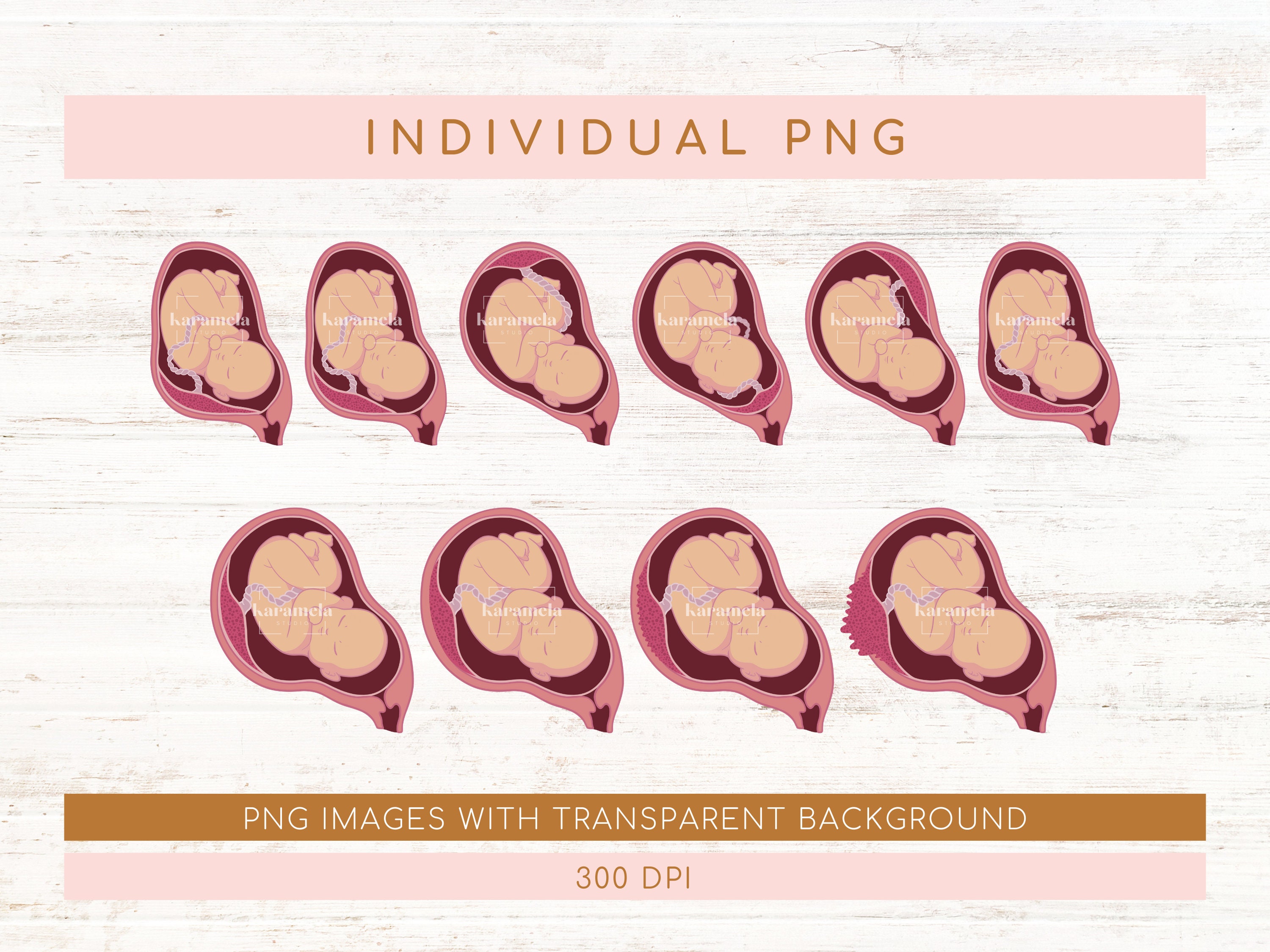 Different Placental Positions Types of Placenta Previa Placenta Accreta ...