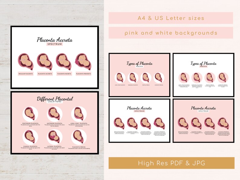 Different Placental Positions | Types of Placenta Previa | Placenta ...