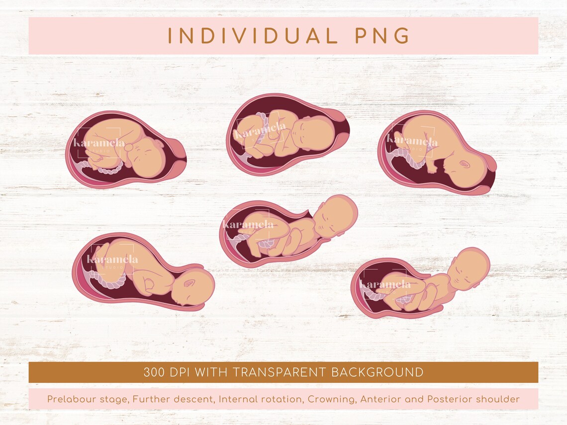 Mechanism of Labour | Stages of Birth | PNG Images & Canva | PDF + JPG ...