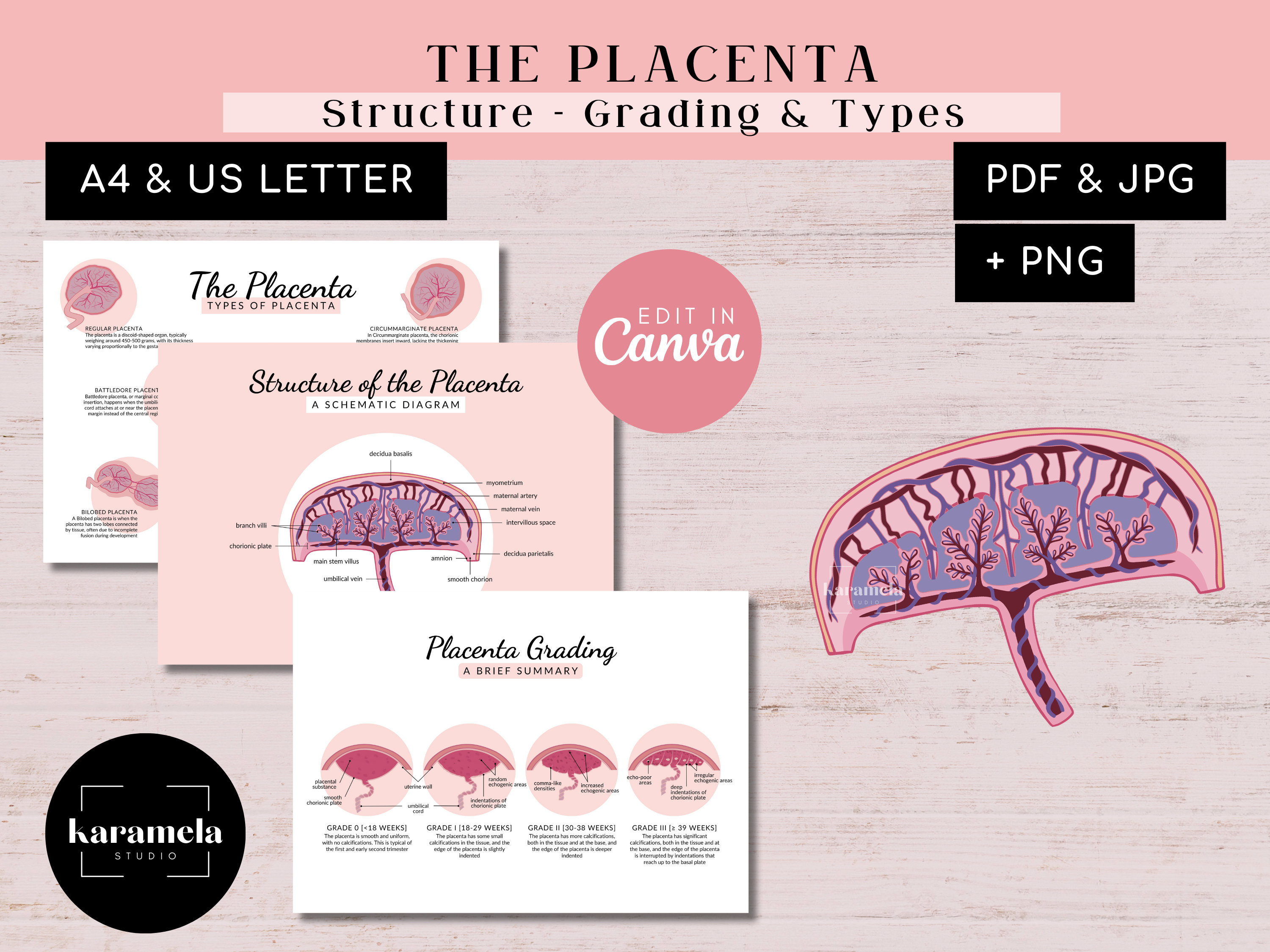 Placenta Structure | Placenta Grading | Different Placenta Types | PNG ...