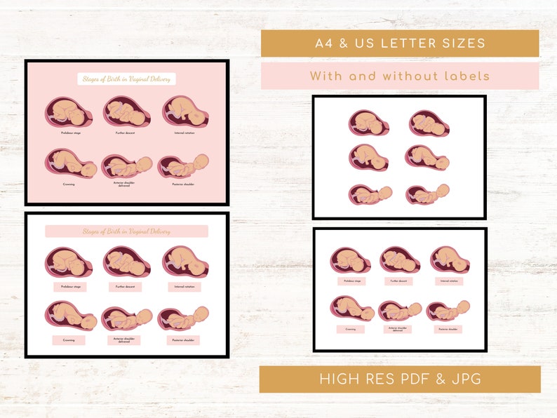 Mechanism of Labour Stages of Birth PNG Images & Canva PDF JPG Female ...