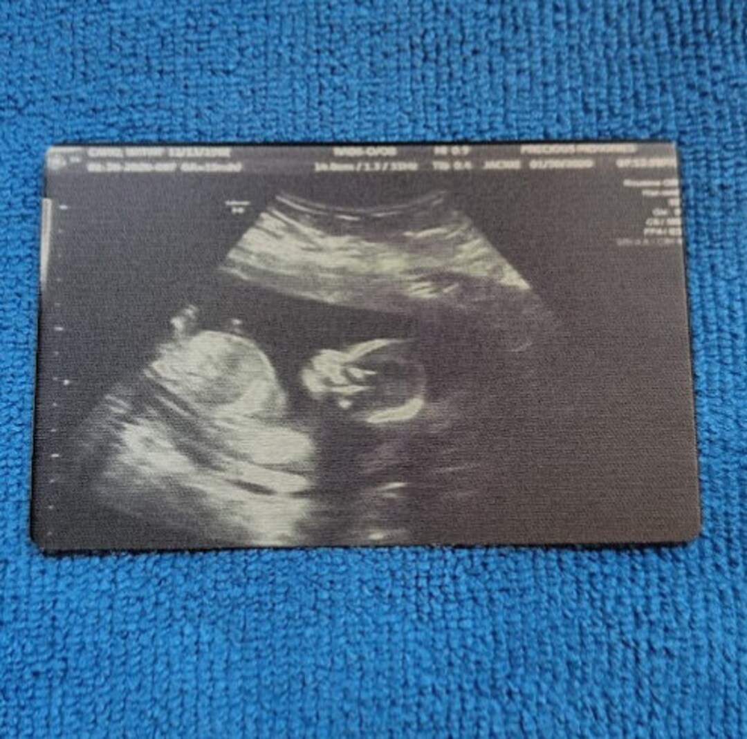 Custom Laser Ultrasound Aluminum Anodized Cards, Great for Gifts ...