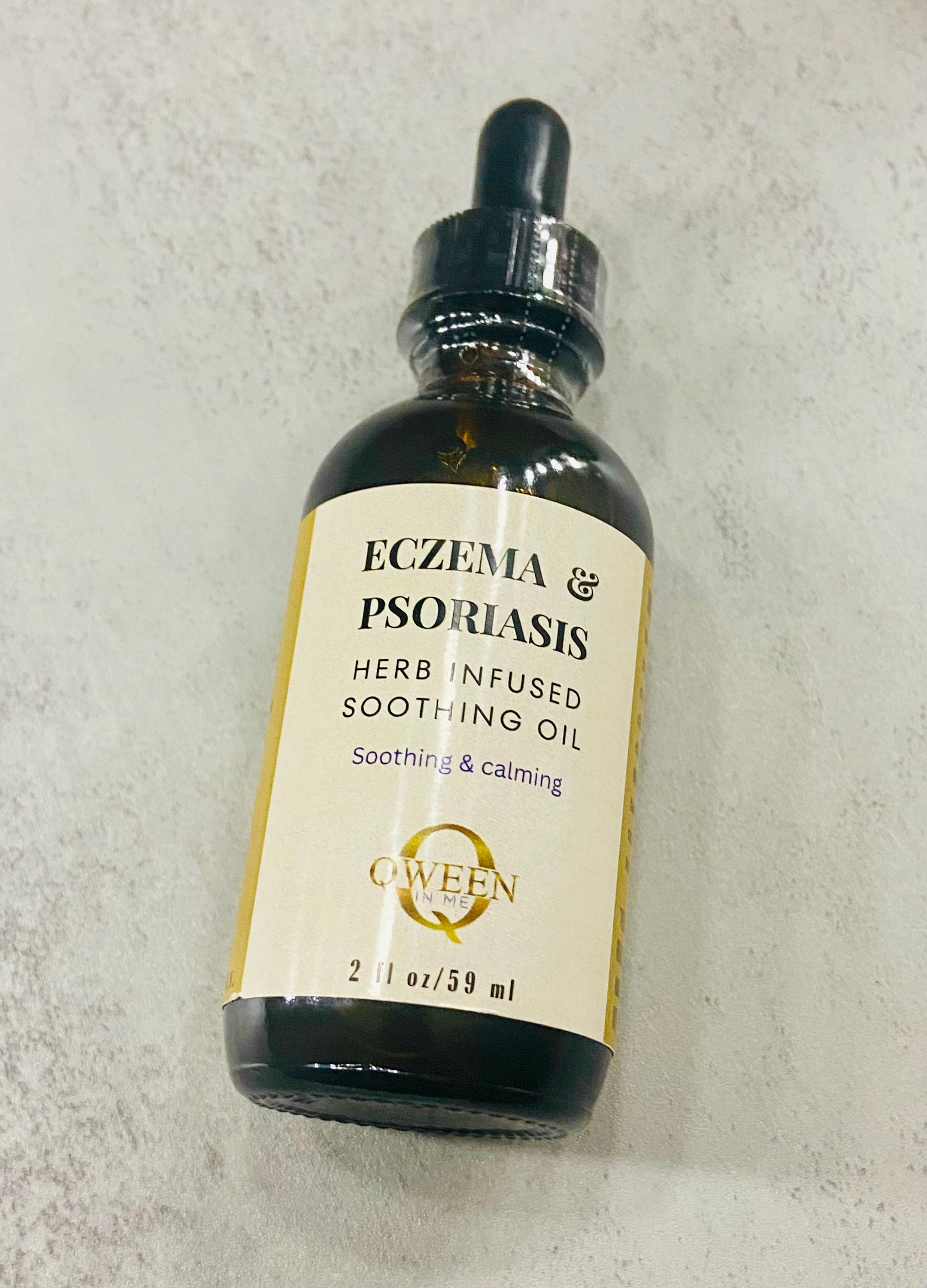 Psoriasis | Eczema | Seborrheic Dermatitis Healing Oil - Etsy Canada