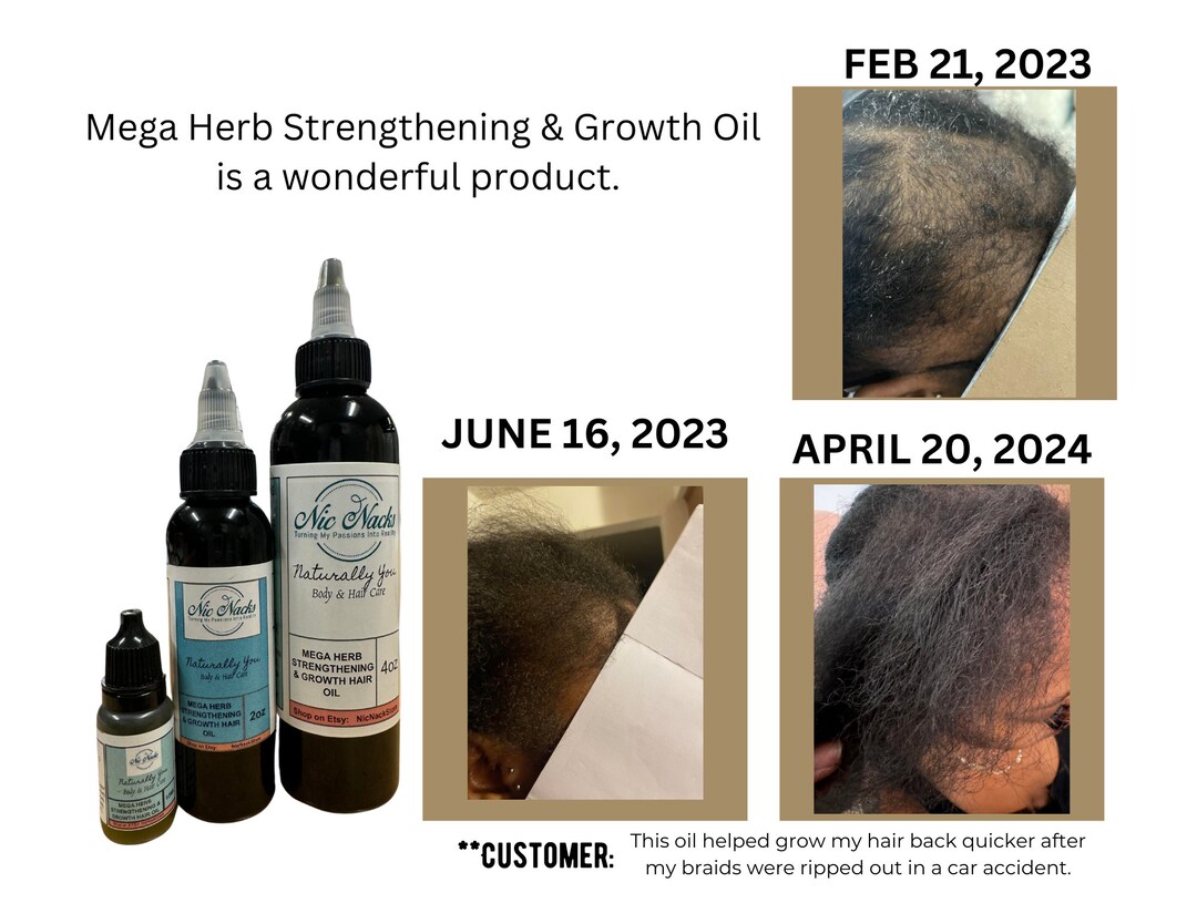 Mega Herb Strengthening & Growth Oil, Hair Loss, - Etsy