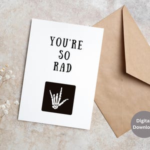 Printable 'you're so Rad' Radiologist Card (digital Download) - Etsy