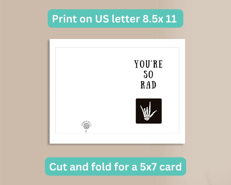 Printable 'you're so Rad' Radiologist Card (digital Download) - Etsy