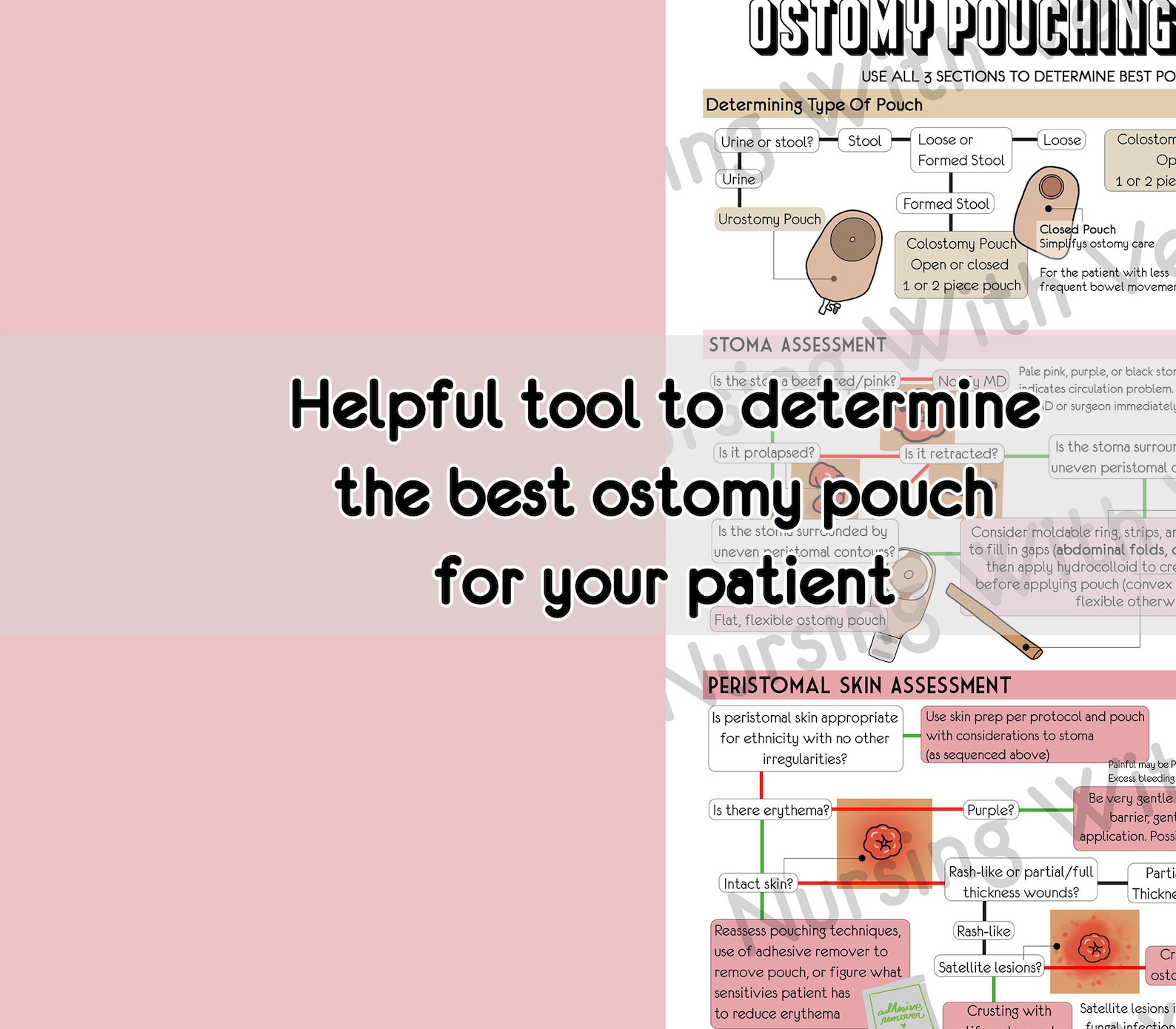 Ostomy Pouch Flowchart - Clinical Guide - Nursing School - Digital ...