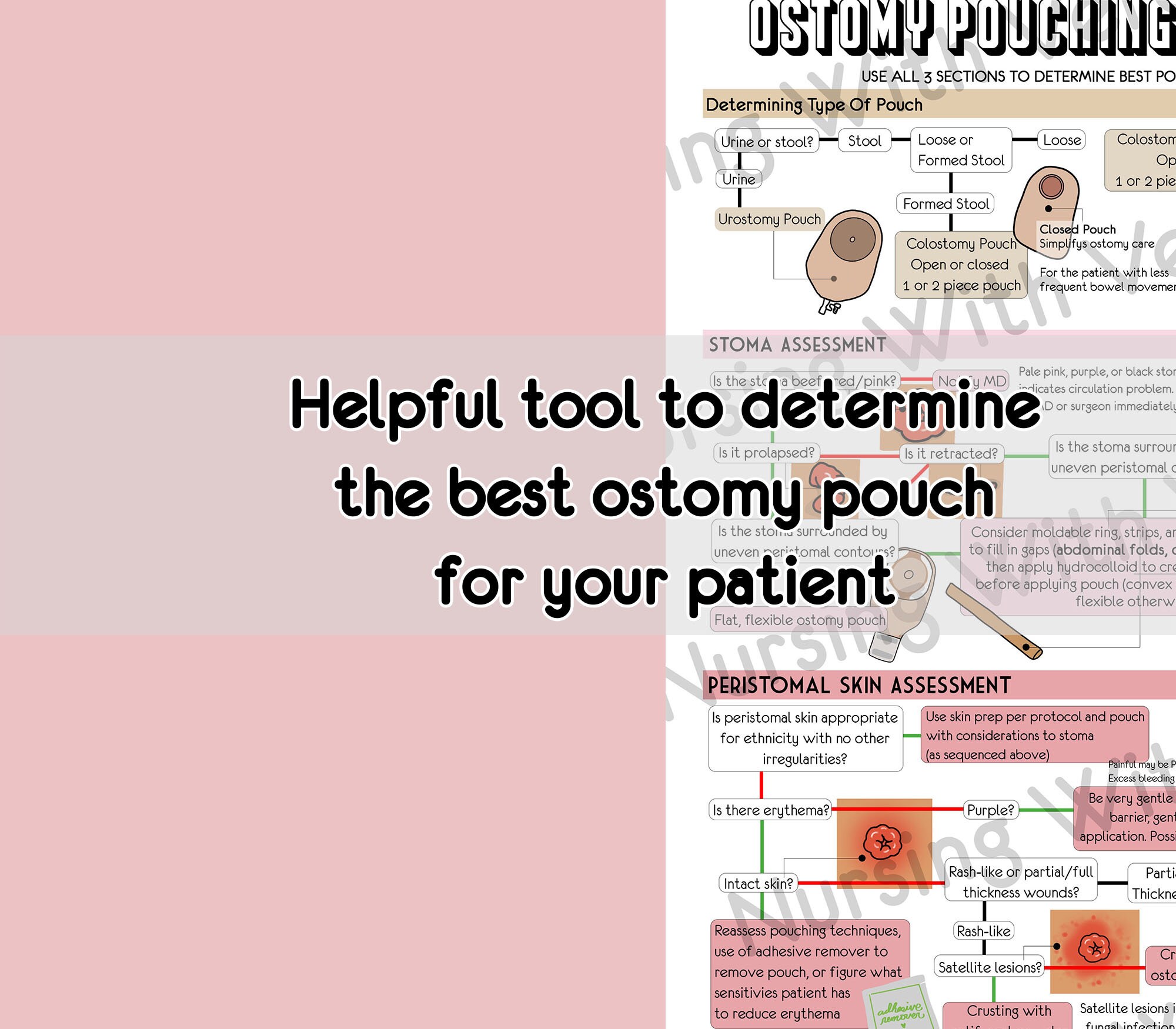 Ostomy Pouch Flowchart Clinical Guide Nursing School Digital Printable