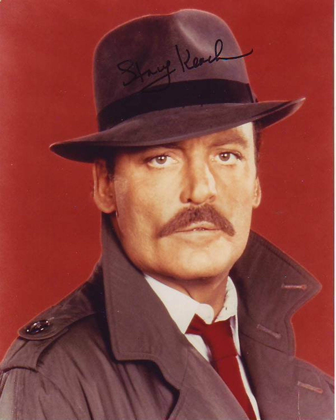Stacy Keach Cleft Lip