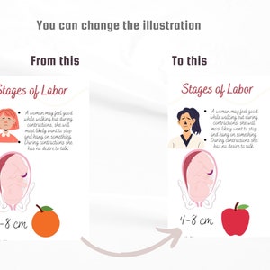 Stages of Labor and Delivery Poster and Birth Stages Cards. Birth ...