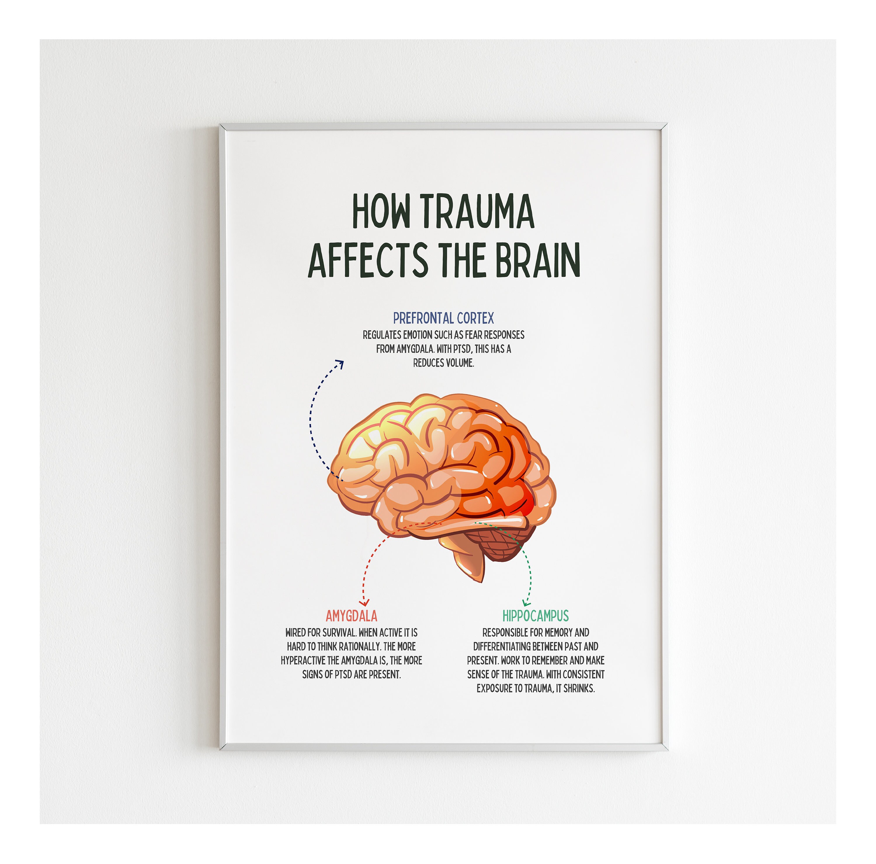 How Trauma Affect Brain Office Decor Therapy Office School - Etsy