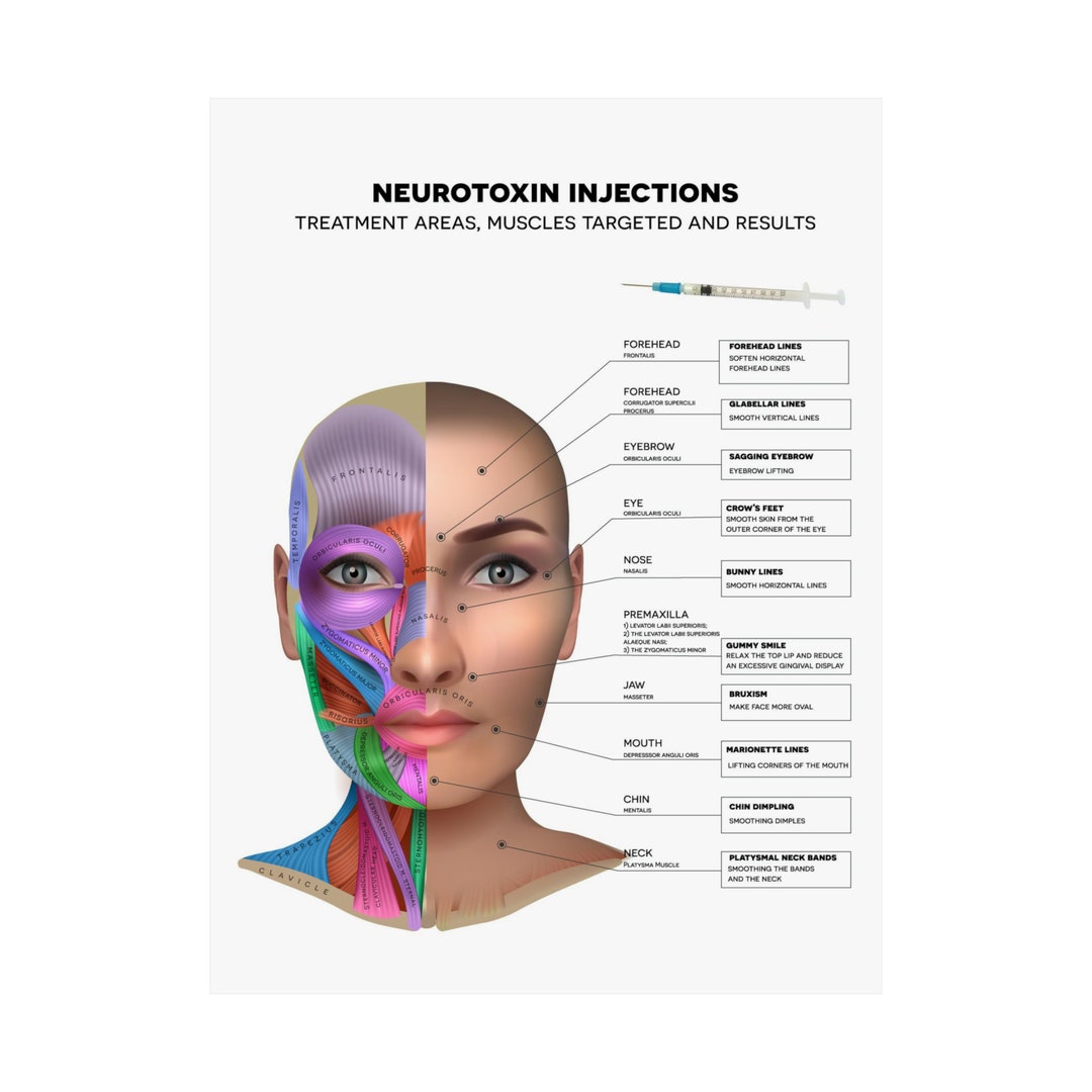 Neurotoxin Injections Treatment Areas, Muscles Targeted, Results ...