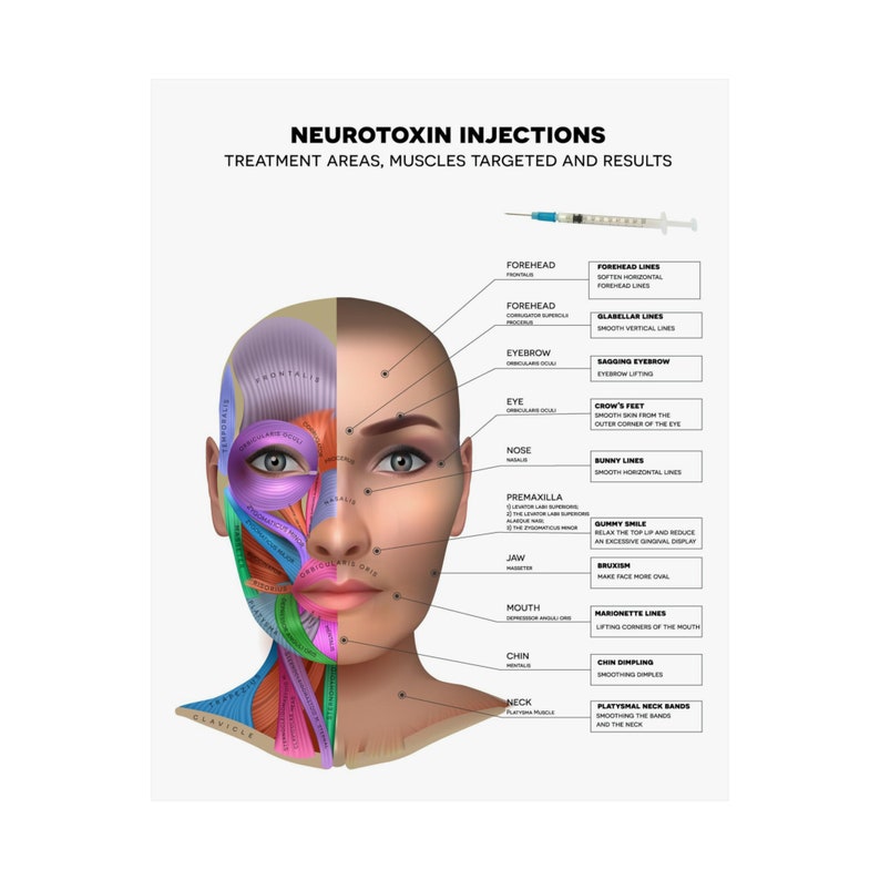 Neurotoxin Injections Treatment Areas, Muscles Targeted, Results ...