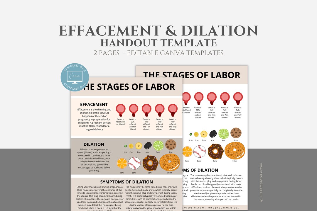 Effacement and Dilation Handout Template, Doula Tool, Birth Education ...