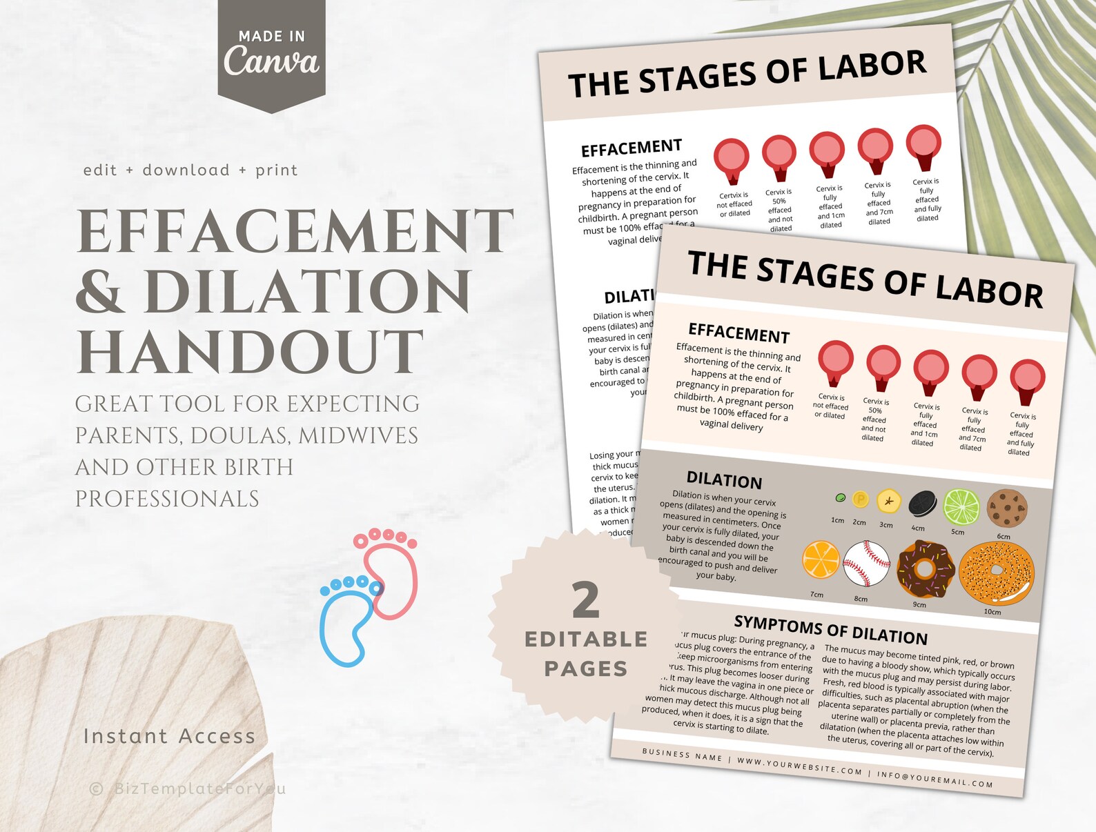 Effacement and Dilation Handout Template Doula Tool Birth - Etsy
