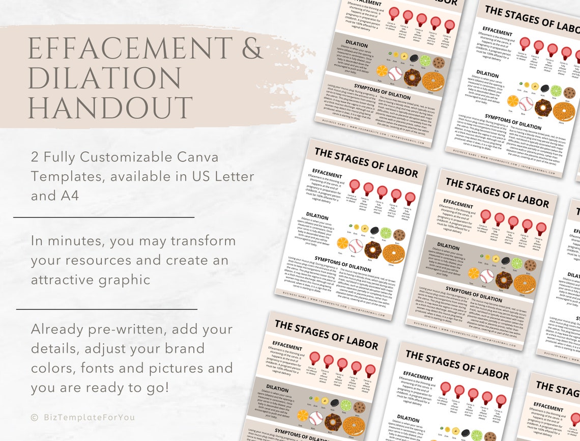 Effacement and Dilation Handout Template Doula Tool Birth - Etsy