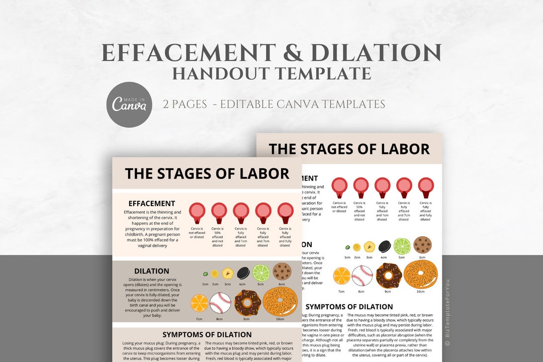 Effacement and Dilation Handout Template, Doula Tool, Birth Education ...