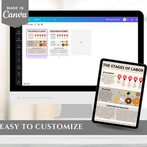 Effacement and Dilation Handout Template, Doula Tool, Birth Education ...