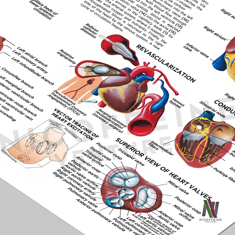 The Anatomy of Human Heart / Heart Diagram / Chart for Large Poster ...