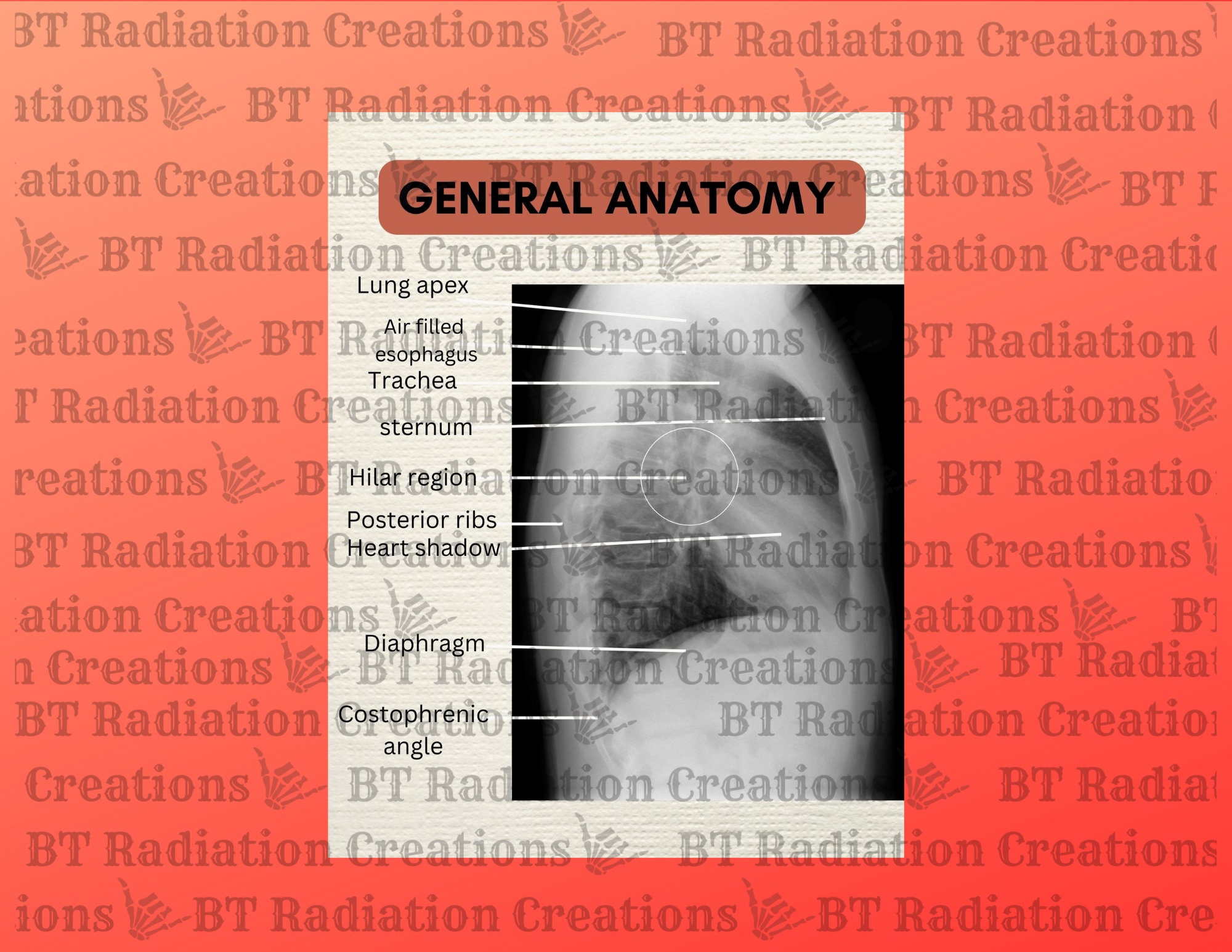 Study Guide, Chest X-ray, Chest Radiograph, Positioning and Procedures ...