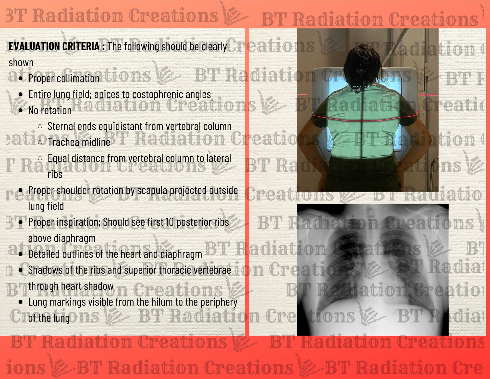 Study Guide, Chest X-ray, Chest Radiograph, Positioning and Procedures ...